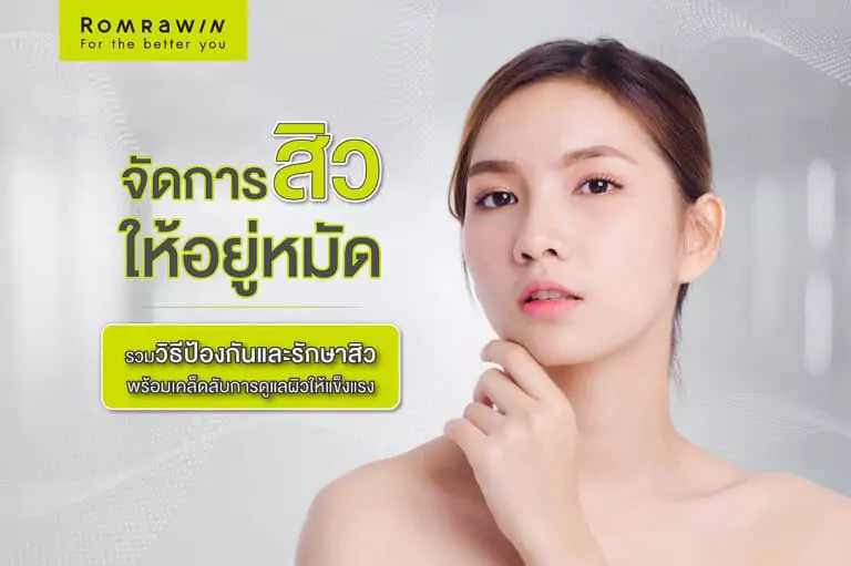 รวมวิธีรักษาสิว พร้อมเคล็ดลับดูแลผิวให้สวย ห่างไกลสิว